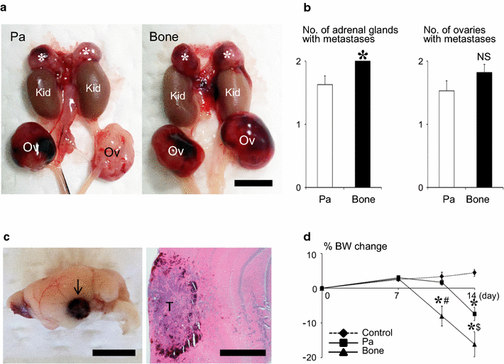 Establishment and characterization of a C57BL/6 mouse model of bone ...