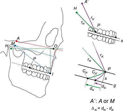 Impact of arbitrary and mean transfer of dental casts to the ...