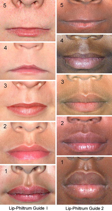 Fetal alcohol spectrum disorders | SpringerLink