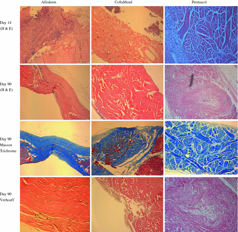 Dermal collagen matrices for ventral hernia repair: comparative ...