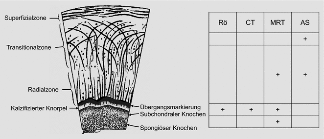 Begutachtung des Knorpelschadens | SpringerLink