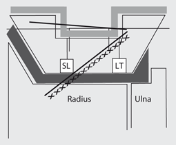 Begutachtung der SL- und LT-Band-Schäden | SpringerLink