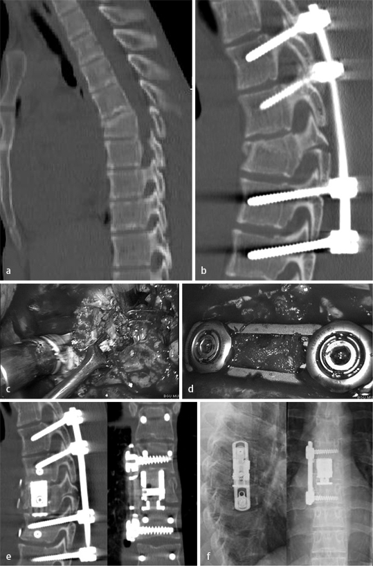 Therapiestandards bei Verletzungen der BWS/LWS | SpringerLink