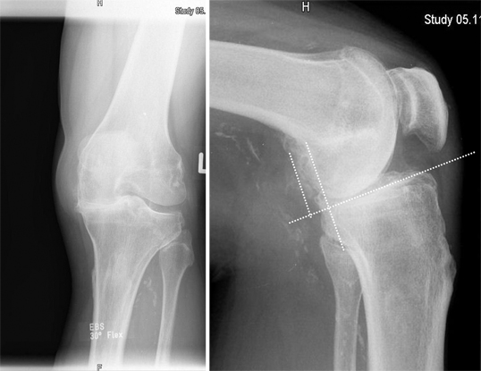 Bandverletzungen des Kniegelenks | SpringerLink