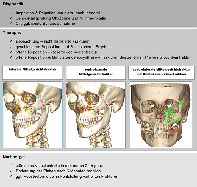 Mund-, Kiefer- und Gesichtsverletzungen | SpringerLink
