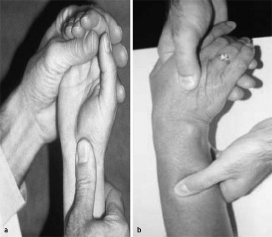 Ligamentäre Handwurzelverletzungen | SpringerLink