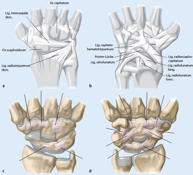 Perilunäre Luxationen und Luxationsfrakturen an der Handwurzel ...