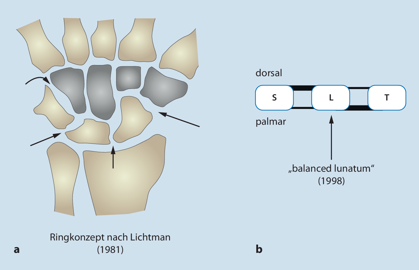 Ligamentum scapholunare und dessen Begutachtung | SpringerLink