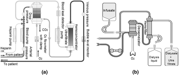 Extracorporeal carbon dioxide removal (ECCO2R) in respiratory ...