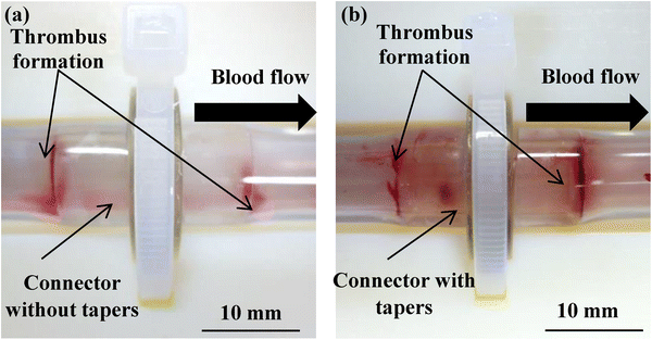 Investigation of the influence of fluid dynamics on thrombus growth at ...