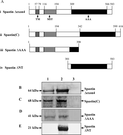 Spastin, the most commonly mutated protein in hereditary spastic ...