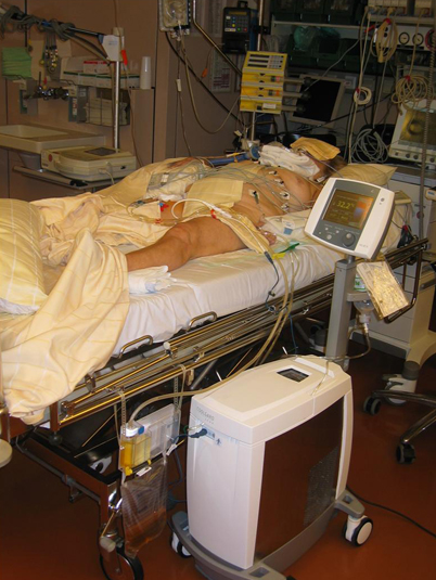 Therapeutische Hypothermie | SpringerLink