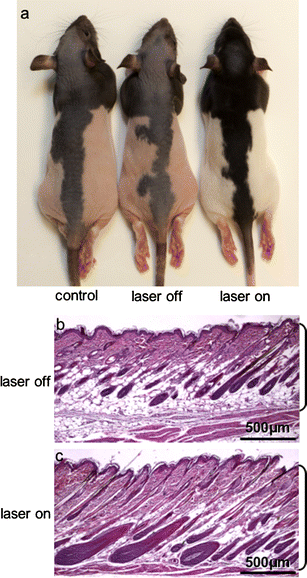 Low-level laser treatment accelerated hair regrowth in a rat model of ...