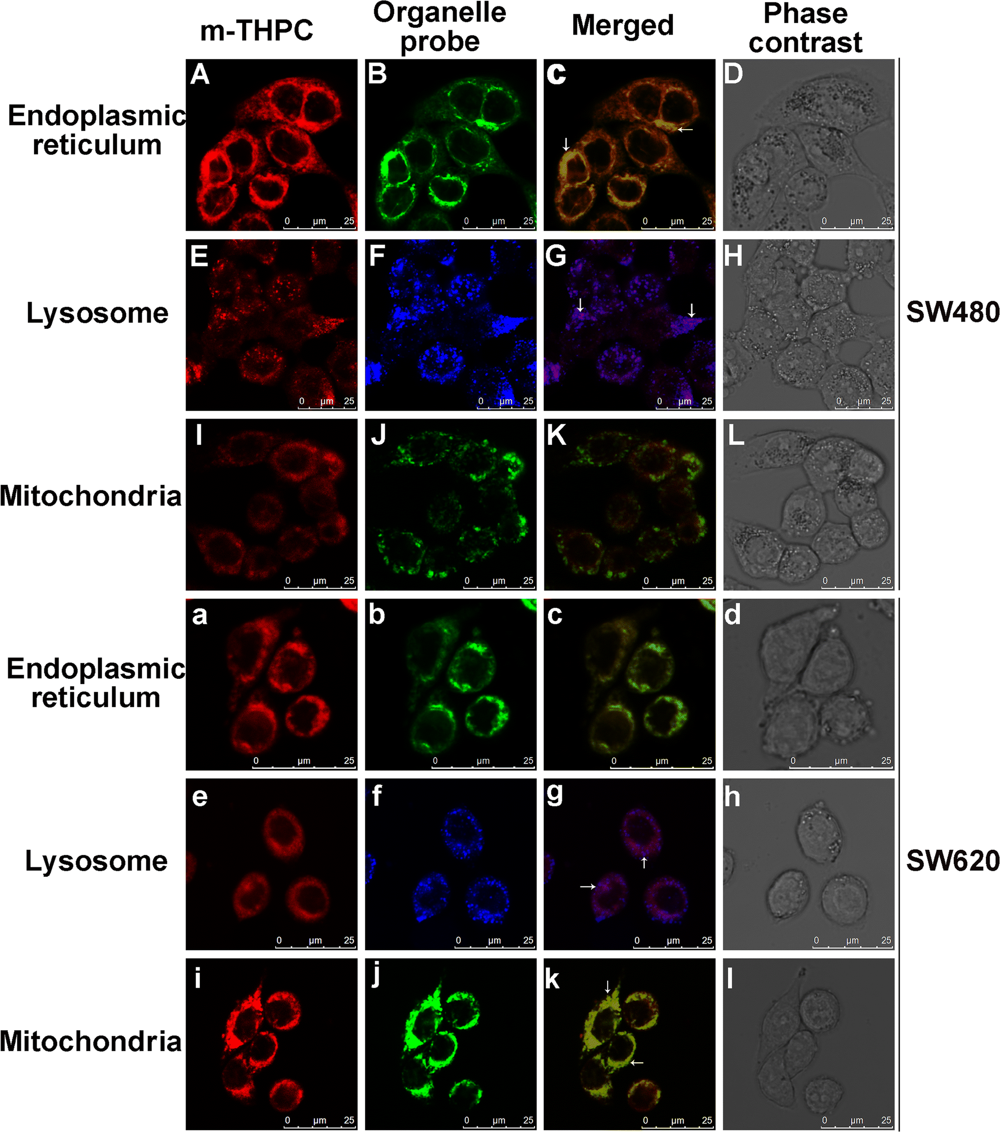 Effects of meta-tetrahydroxyphenylchlorin photodynamic therapy on ...