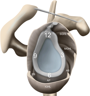 Inferior glenohumeral ligament (IGHL) complex: anatomy, injuries ...