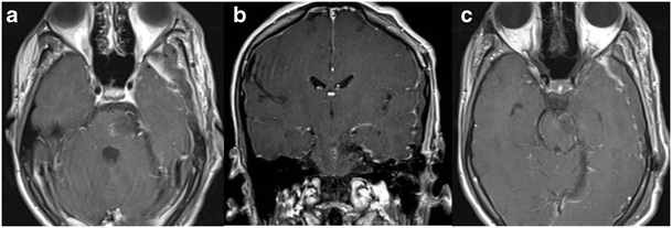 Fourth cranial nerve: surgical anatomy in the subtemporal ...