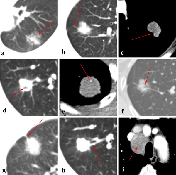 Diagnostic accuracy of computed tomography imaging for the detection of ...