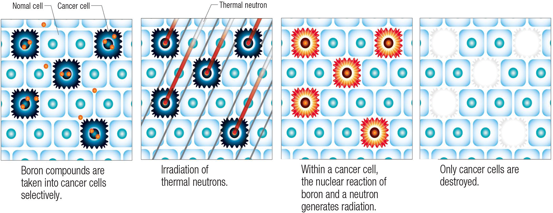 Boron neutron capture therapy (BNCT): a unique role in radiotherapy ...