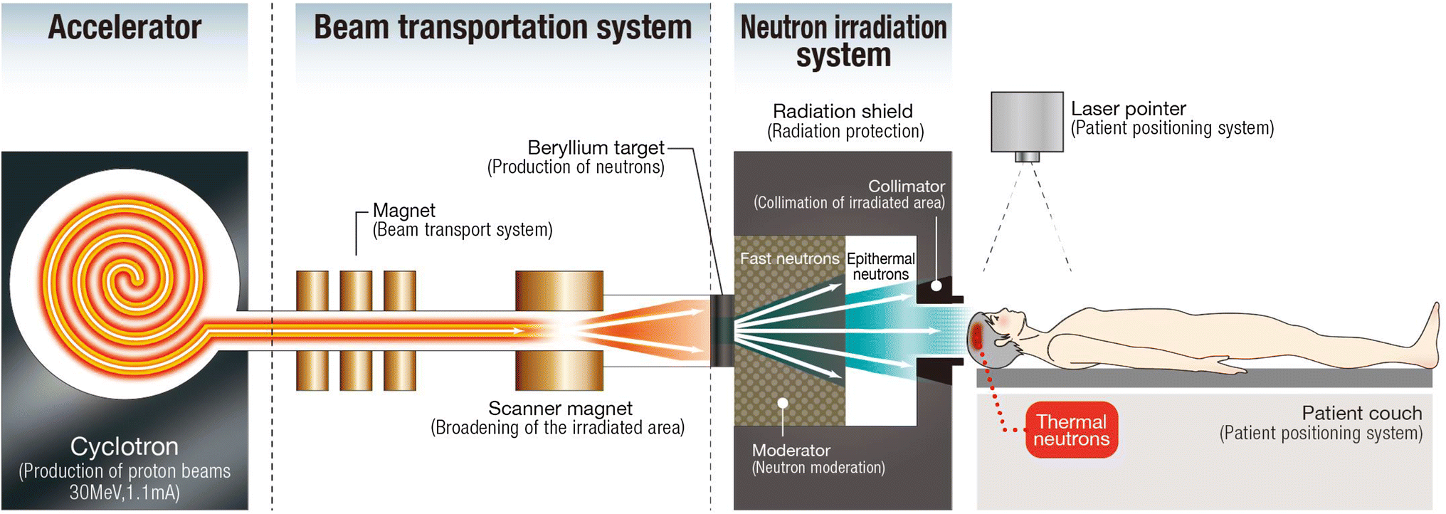 Boron neutron capture therapy (BNCT): a unique role in radiotherapy with a view to entering the ...