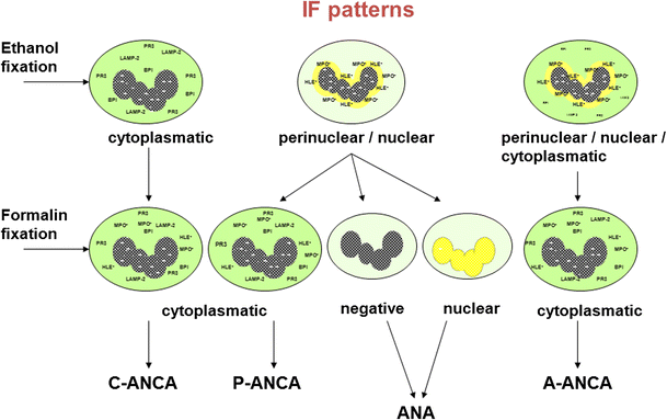 ANCA testing: the current stage and perspectives | SpringerLink