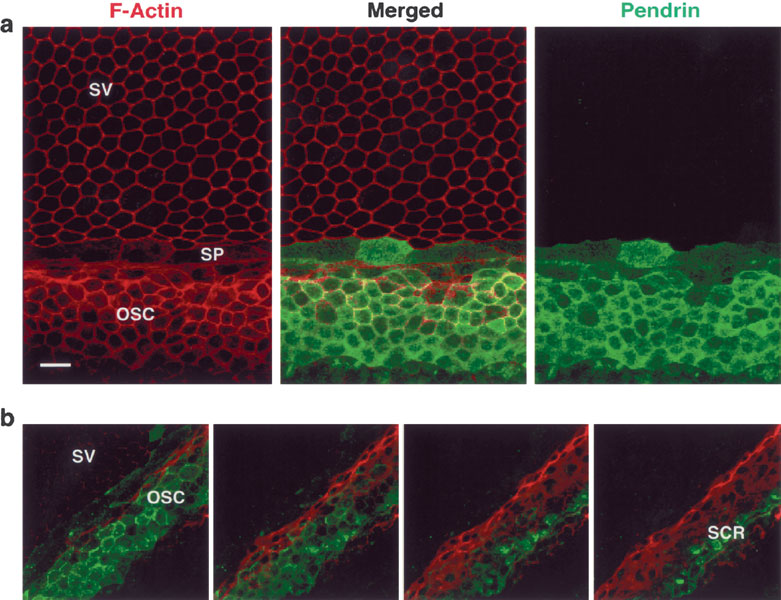 Localization and Functional Studies of Pendrin in the Mouse Inner Ear ...