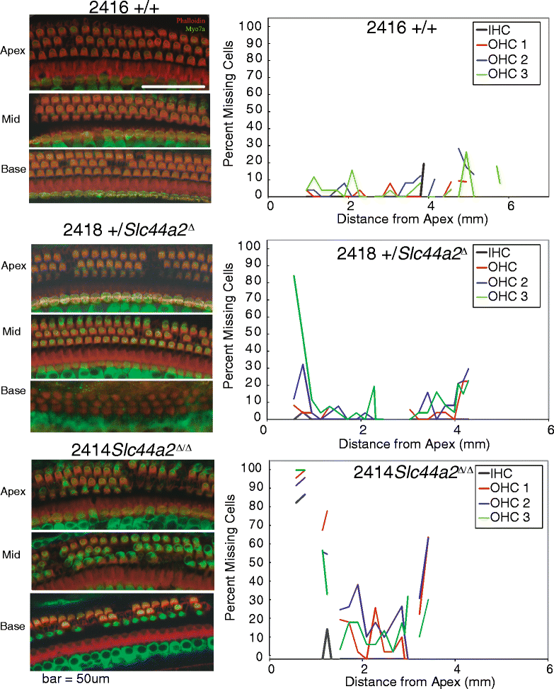 Hair Cell Loss, Spiral Ganglion Degeneration, and Progressive ...