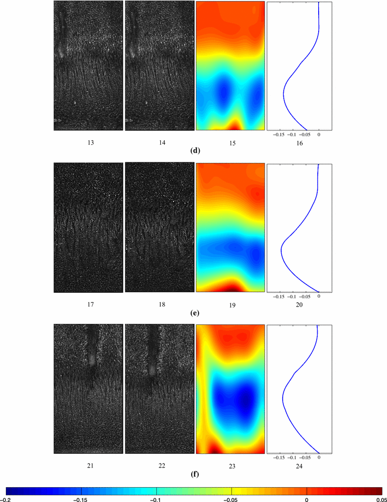 Growth plate cartilage shows different strain patterns in response to ...