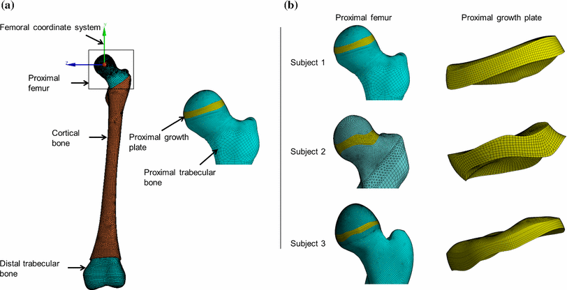 Influence of muscle groups’ activation on proximal femoral growth ...