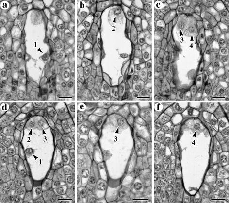 Development and structure of the female gametophyte in Austrobaileya ...