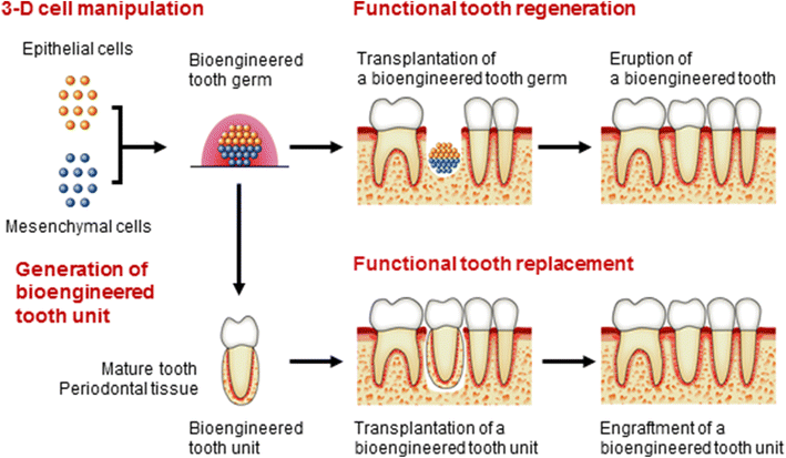 Functional tooth regenerative therapy: tooth tissue regeneration and ...
