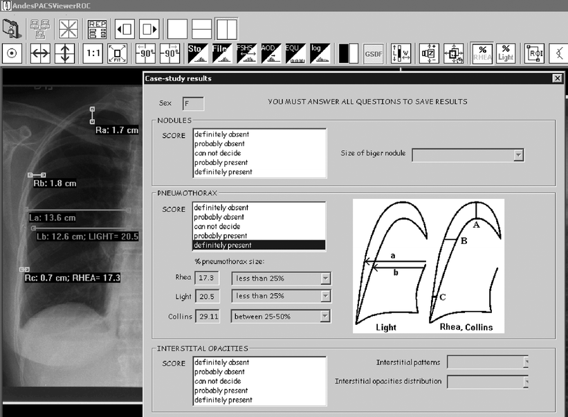 Evaluation of Three Pneumothorax Size Quantification Methods on ...