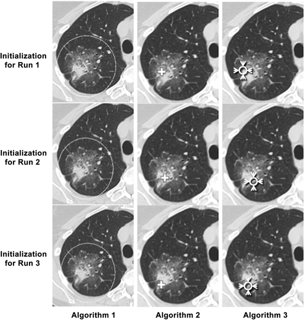 A Comparison of Lung Nodule Segmentation Algorithms: Methods and Results from a Multi ...