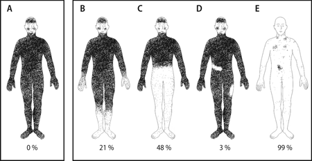 Sweat testing to evaluate autonomic function | SpringerLink
