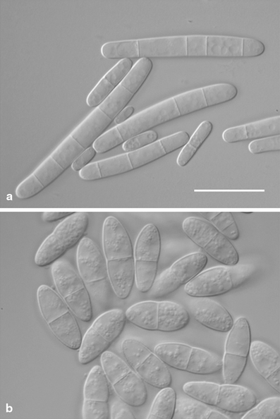 Biology and control of the apple canker fungus Neonectria ditissima ...