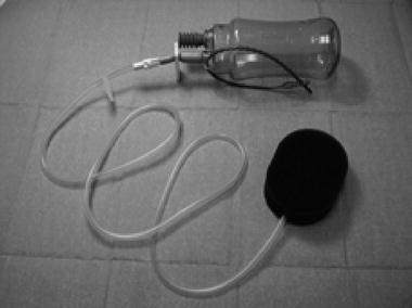 Endo–vacuum Assisted Closure Treatment for Rectal Anastomotic ...