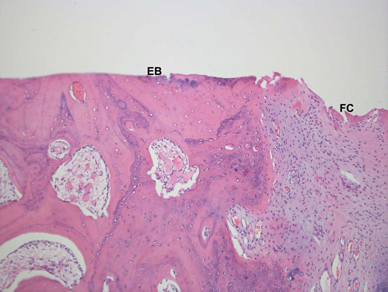 Osteoarthritis: histology and pathogenesis | SpringerLink