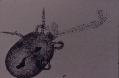 Trombiculiasis: not only a matter of animals! | SpringerLink