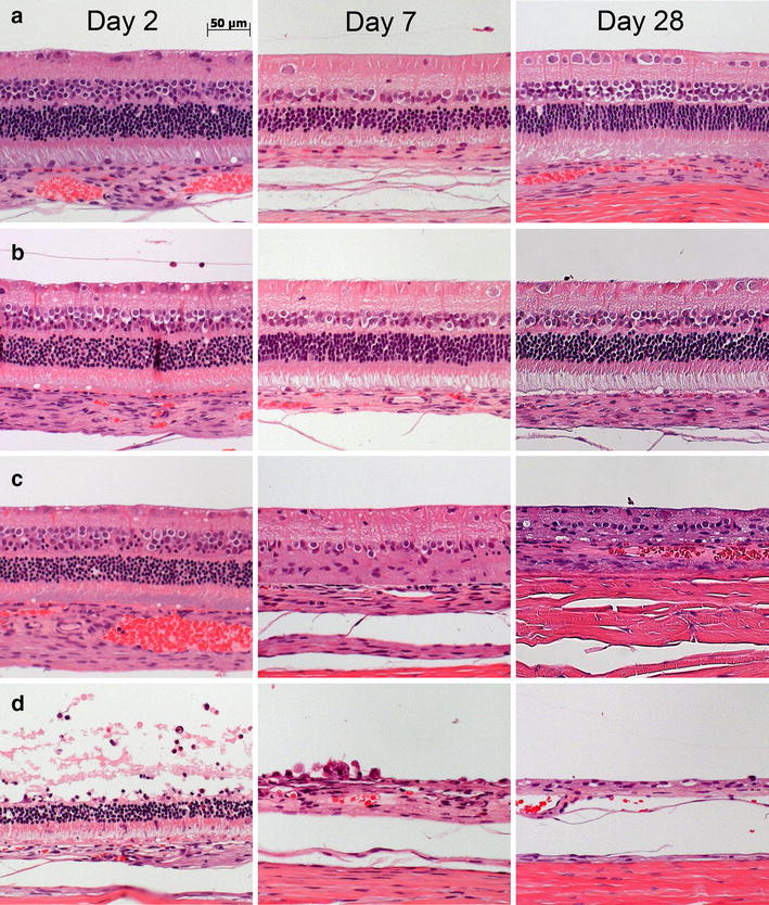 Monocular retinal degeneration induced by intravitreal injection of ...