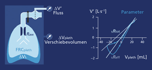Ganzkörperplethysmographie | SpringerLink