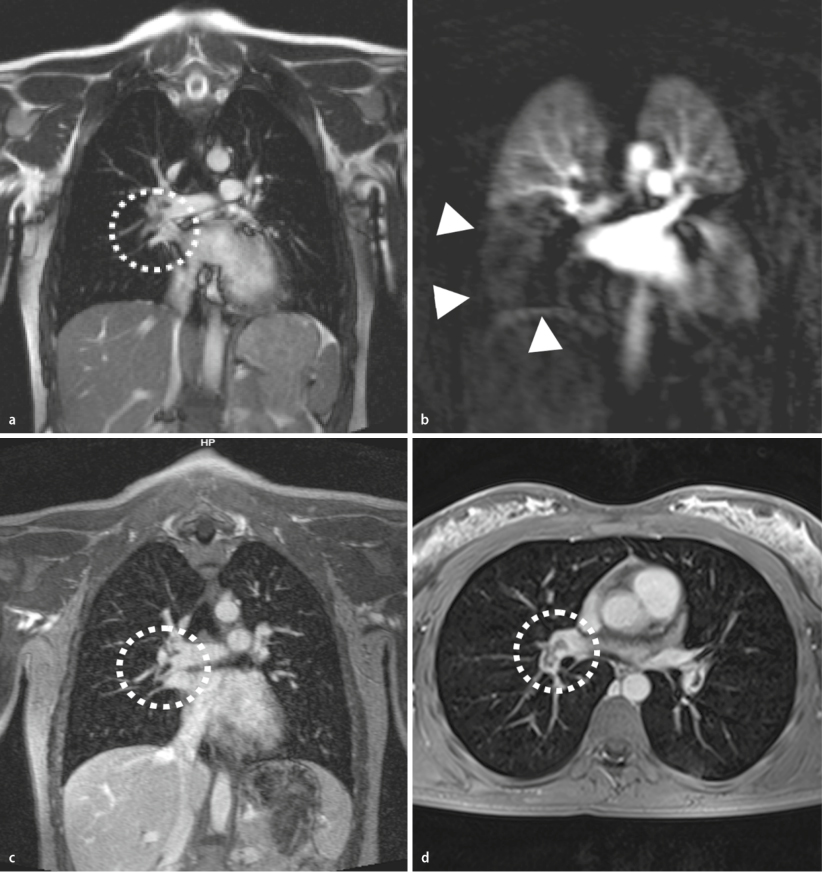 Magnetresonanztomographie | SpringerLink
