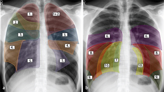 Röntgenuntersuchung des Thorax | SpringerLink