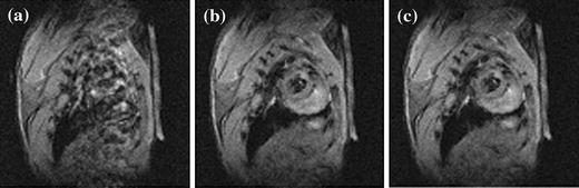 Cardiac and Respiratory MRI Gating Using Combined Wavelet Sub-Band ...