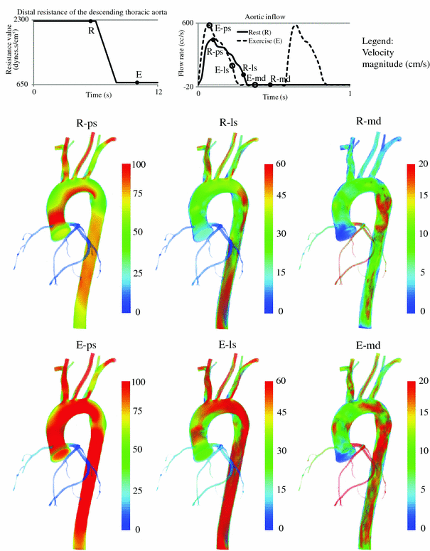 Incorporating Autoregulatory Mechanisms of the Cardiovascular System in Three-Dimensional Finite ...