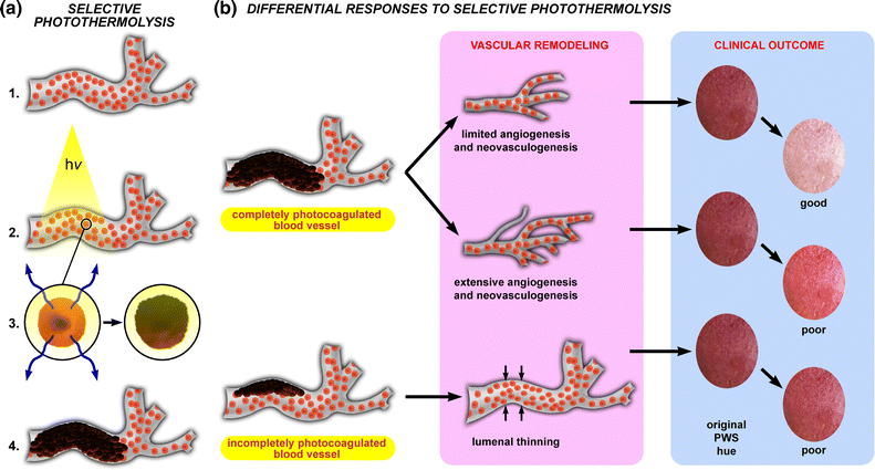 An Overview of Three Promising Mechanical, Optical, and Biochemical ...