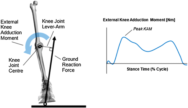 Wedged Insoles and Gait in Patients with Knee Osteoarthritis: A ...
