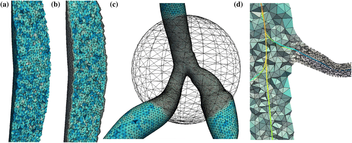 SimVascular: An Open Source Pipeline for Cardiovascular Simulation ...