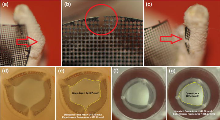 A Tri-Leaflet Nitinol Mesh Scaffold for Engineering Heart Valves ...