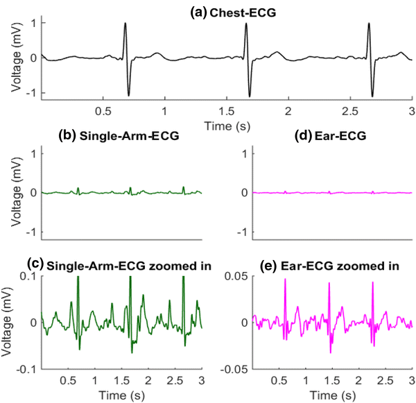 Deep Arm/Ear-ECG Image Learning for Highly Wearable Biometric Human ...