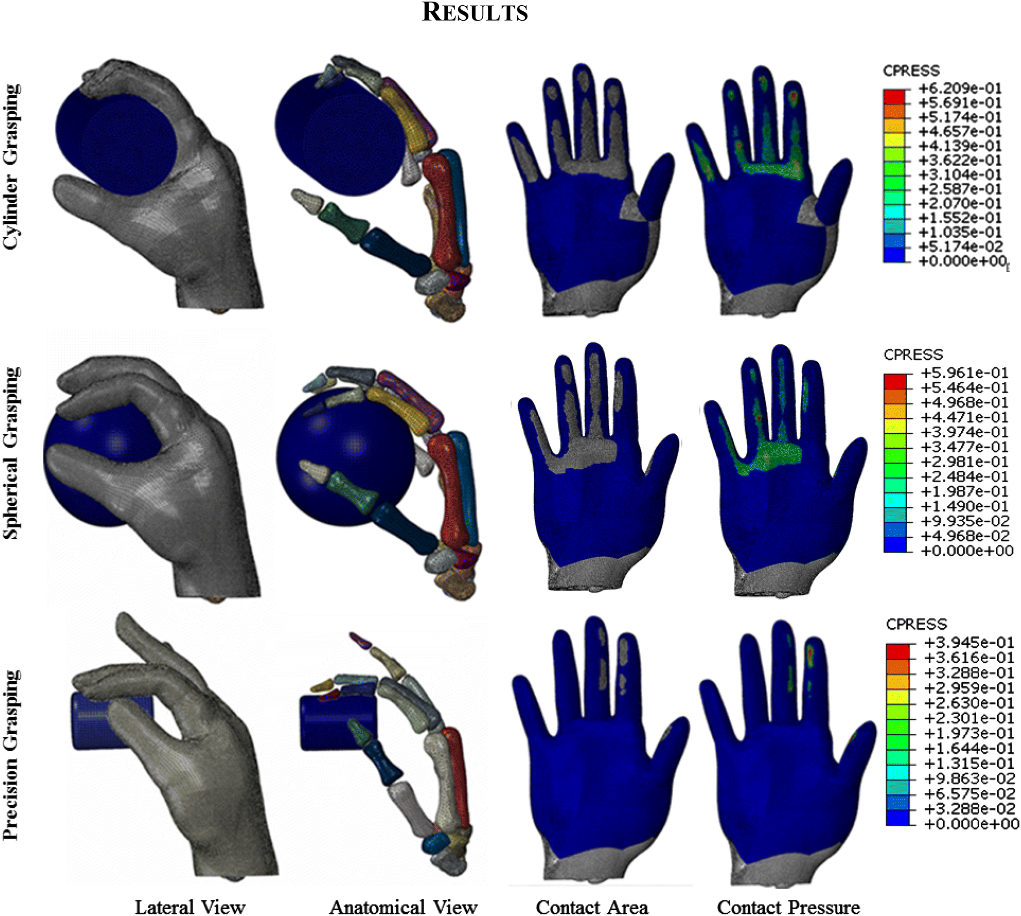 Subject-Specific Finite Element Modelling of the Human Hand Complex ...
