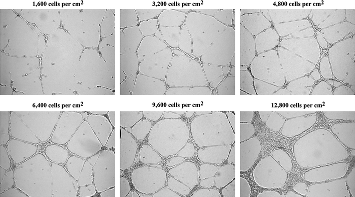 The endothelial cell tube formation assay on basement membrane turns 20 ...